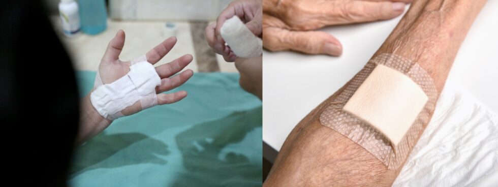 Cuts & Wounds | Montrose Emergency Room