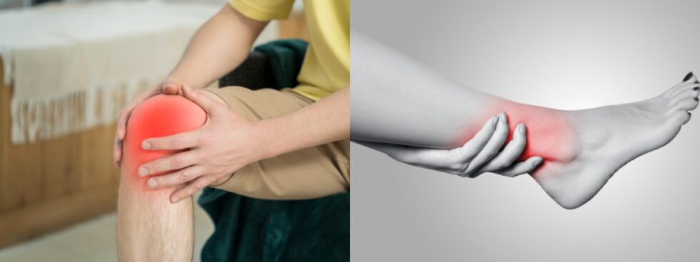 Sprains & Strains | Montrose Emergency Room